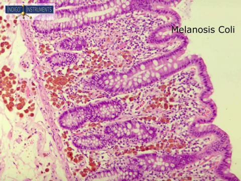 Histopathology Photo CD