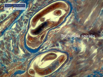 Trichinella spiralis Nematode Worm Parasite